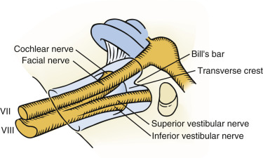 Vestibular Schwannomas Neupsy Key