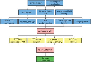 Chapter 16 – Localization and surgery in MRI-negative posterior cortex ...