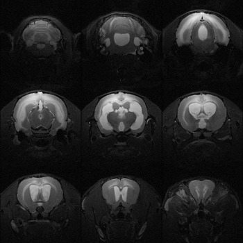 3 – Animal models of hydrocephalus | Neupsy Key